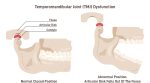 Blog | Sleep & TMJ Therapy